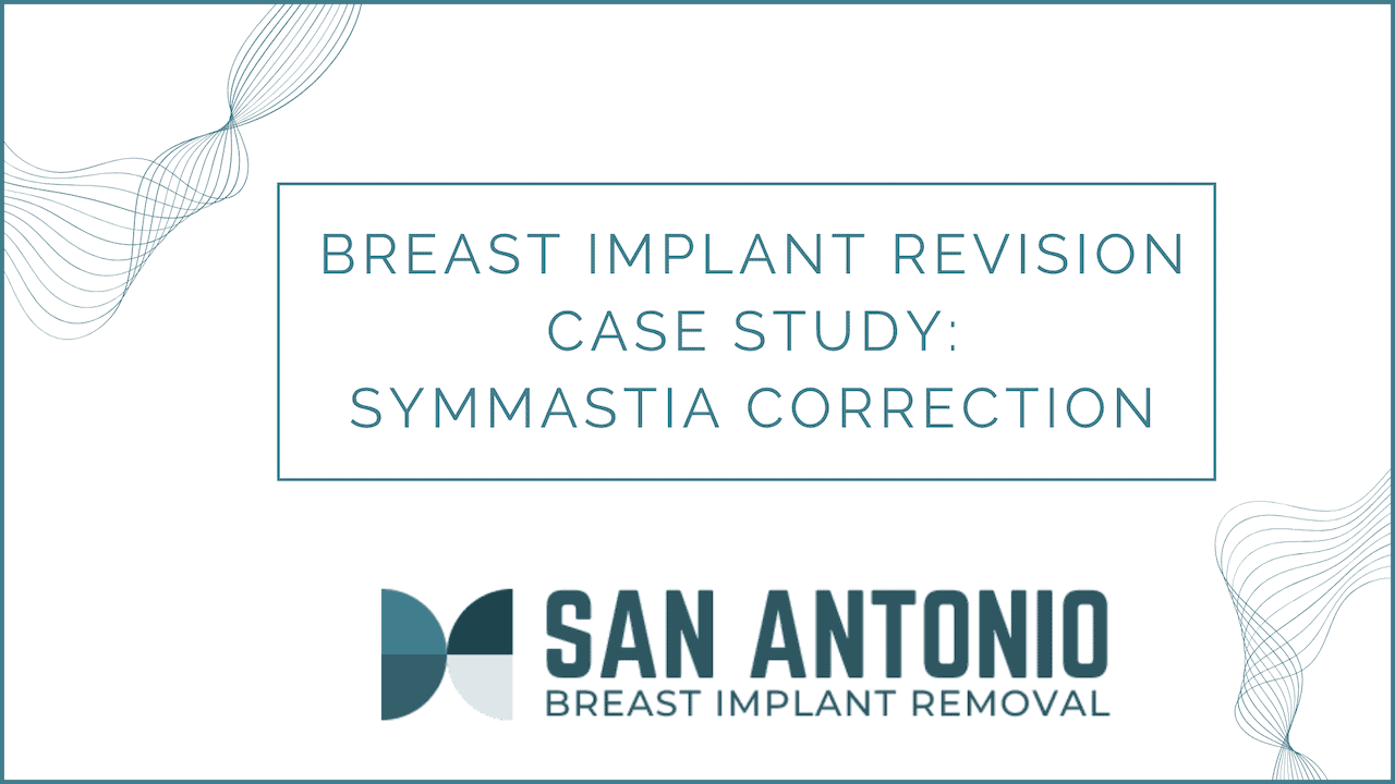 Breast Implant Revision Case Study: Correction of Symmastia